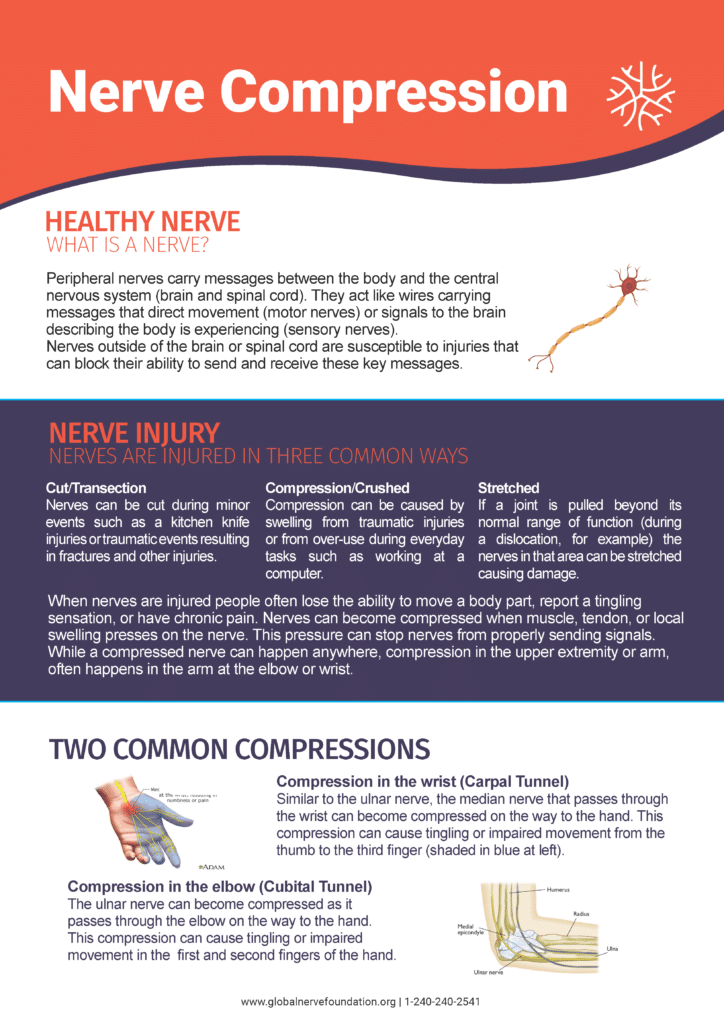 Live better by learning about cubital tunnel - Global Nerve Foundation