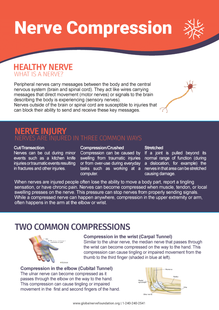 Live better by learning about cubital tunnel - Global Nerve Foundation